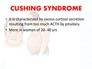 Cushing Disease