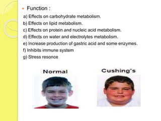 Cushing syndrome | PPTX
