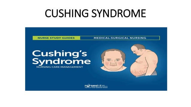 CUSHING SYNDROME.pptx