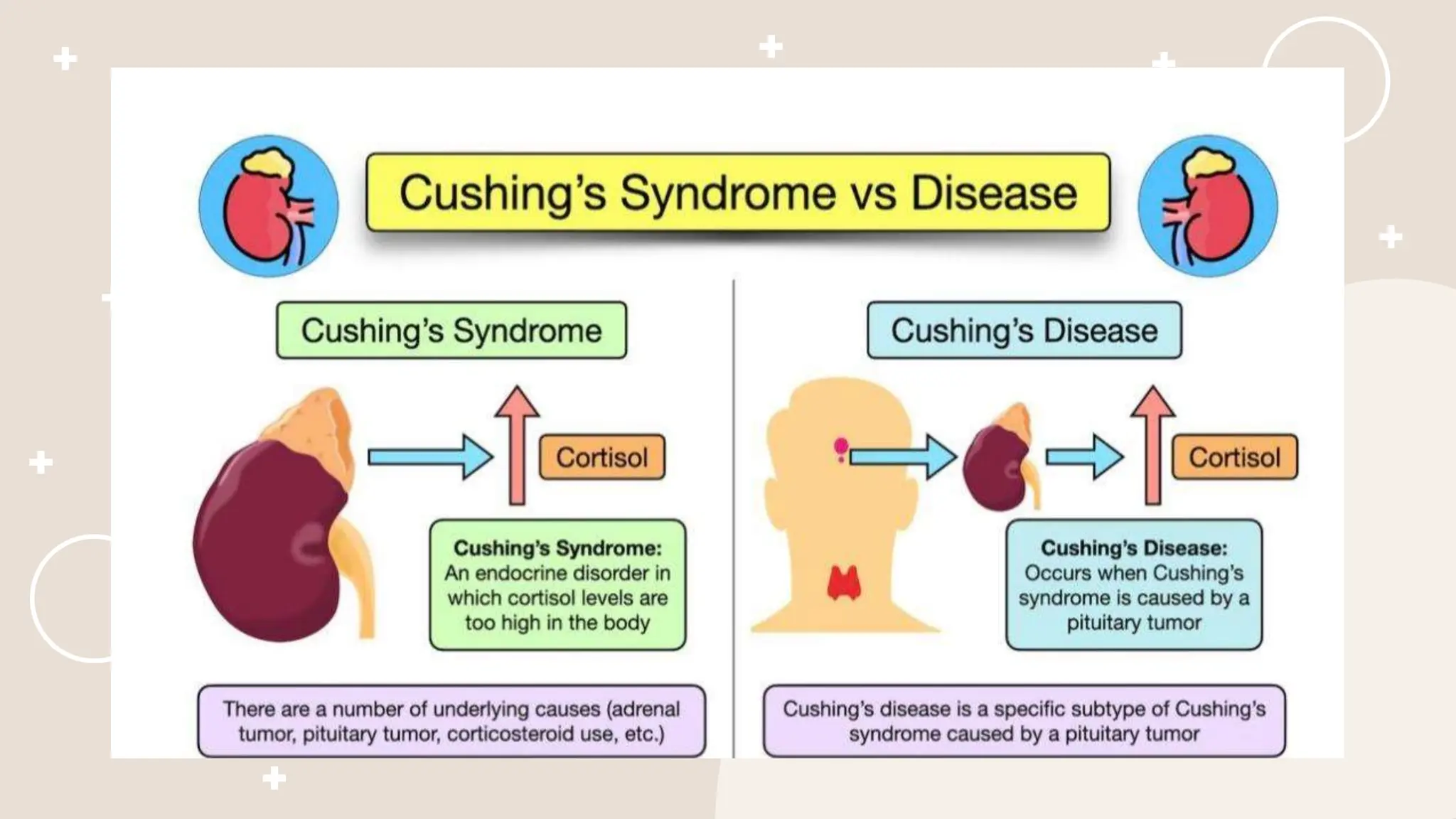 cushing syndrome.pptx which steroid abuse | PPT