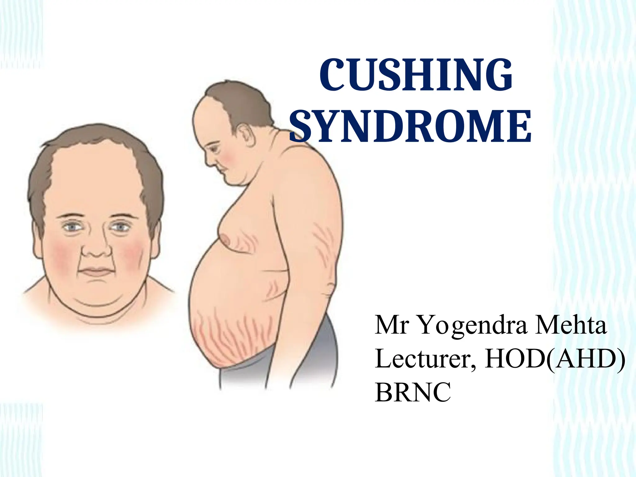 Cushing Syndrome.PPT lecture slide for nursing | PPT