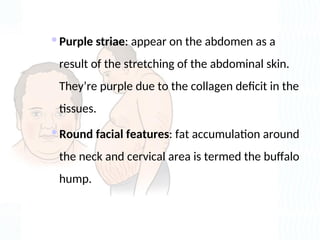 Cushing Syndrome.PPT lecture slide for nursing | PPT