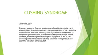 Cushing's Syndrome and aboout it(1).pptx