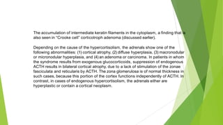 Cushing's Syndrome and aboout it(1).pptx