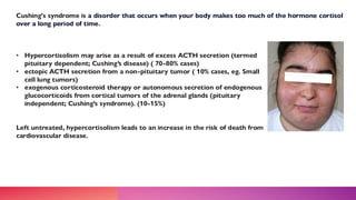 CUSHING SYNDROME AND A CLINICAL REVIEW . | PDF