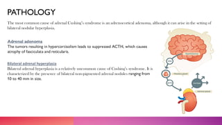 CUSHING SYNDROME and its clinical review | PPT