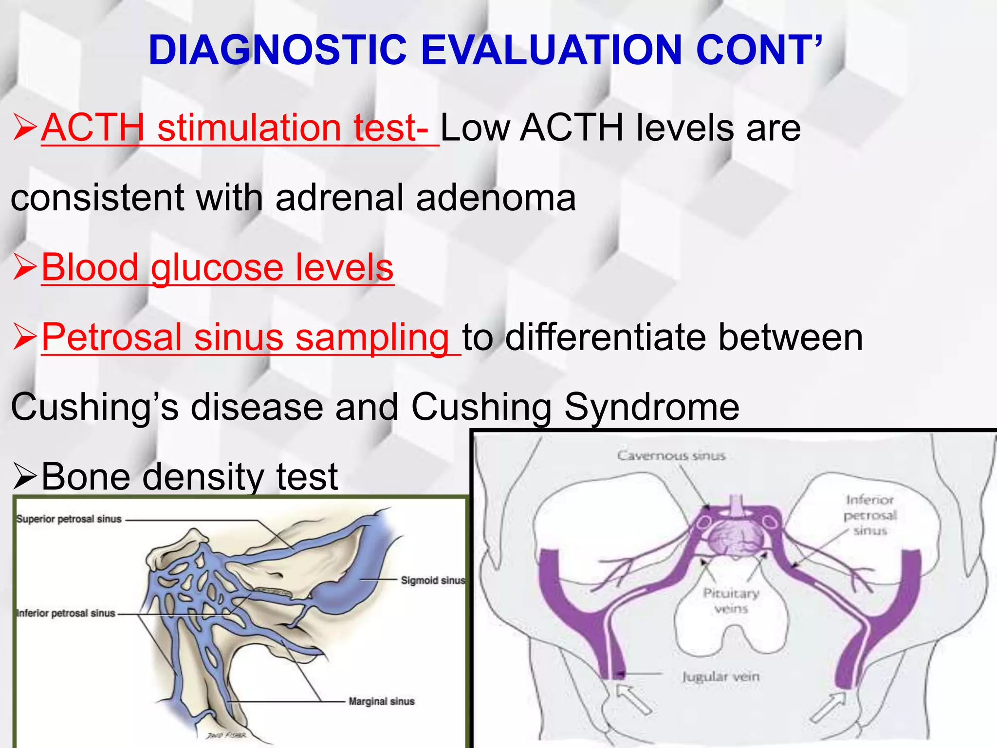 CUSHING SYNDROME | PPTX