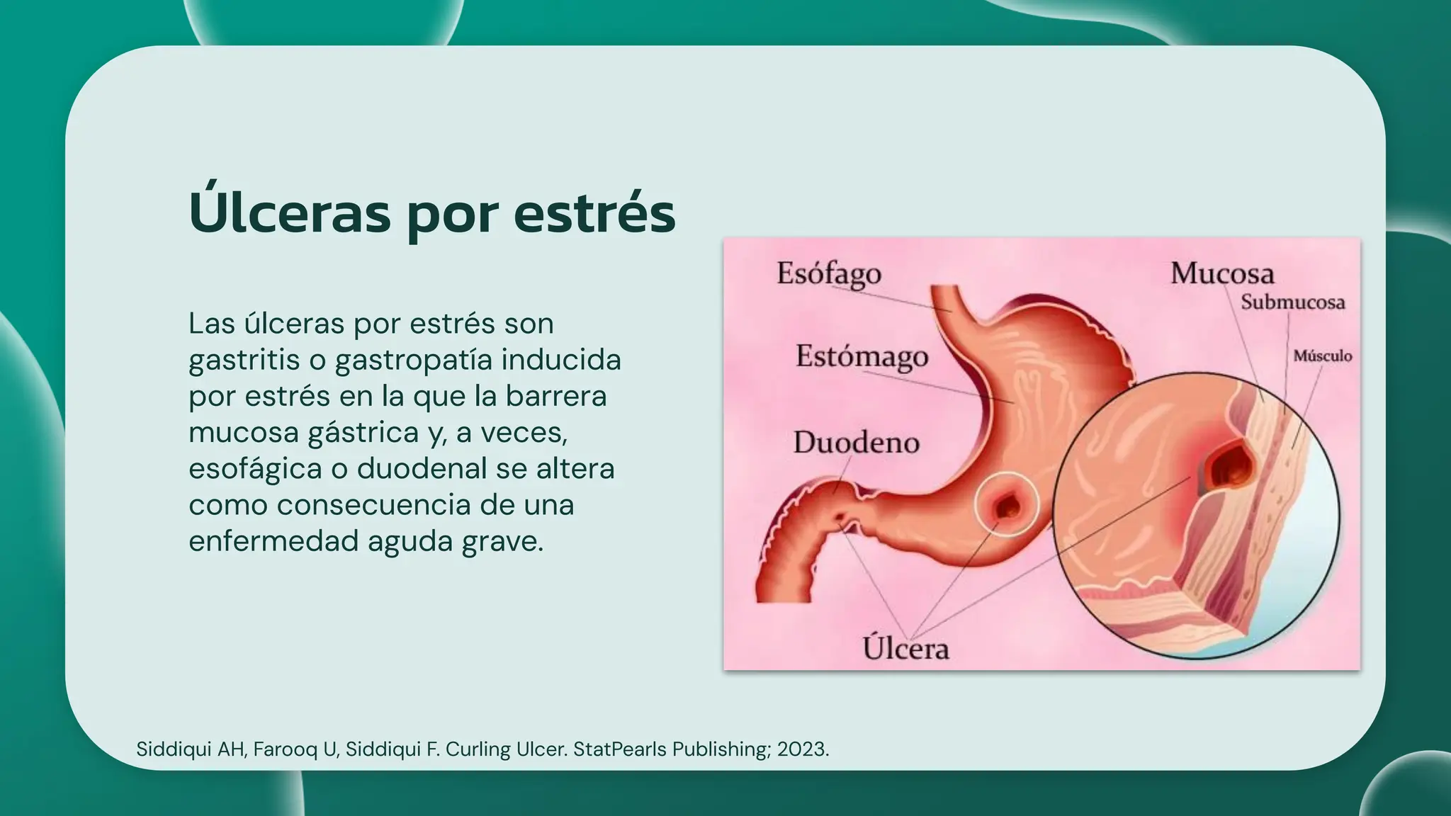 Ulcera de cushing y curling | PDF