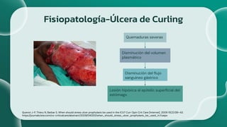 Ulcera de cushing y curling | PDF
