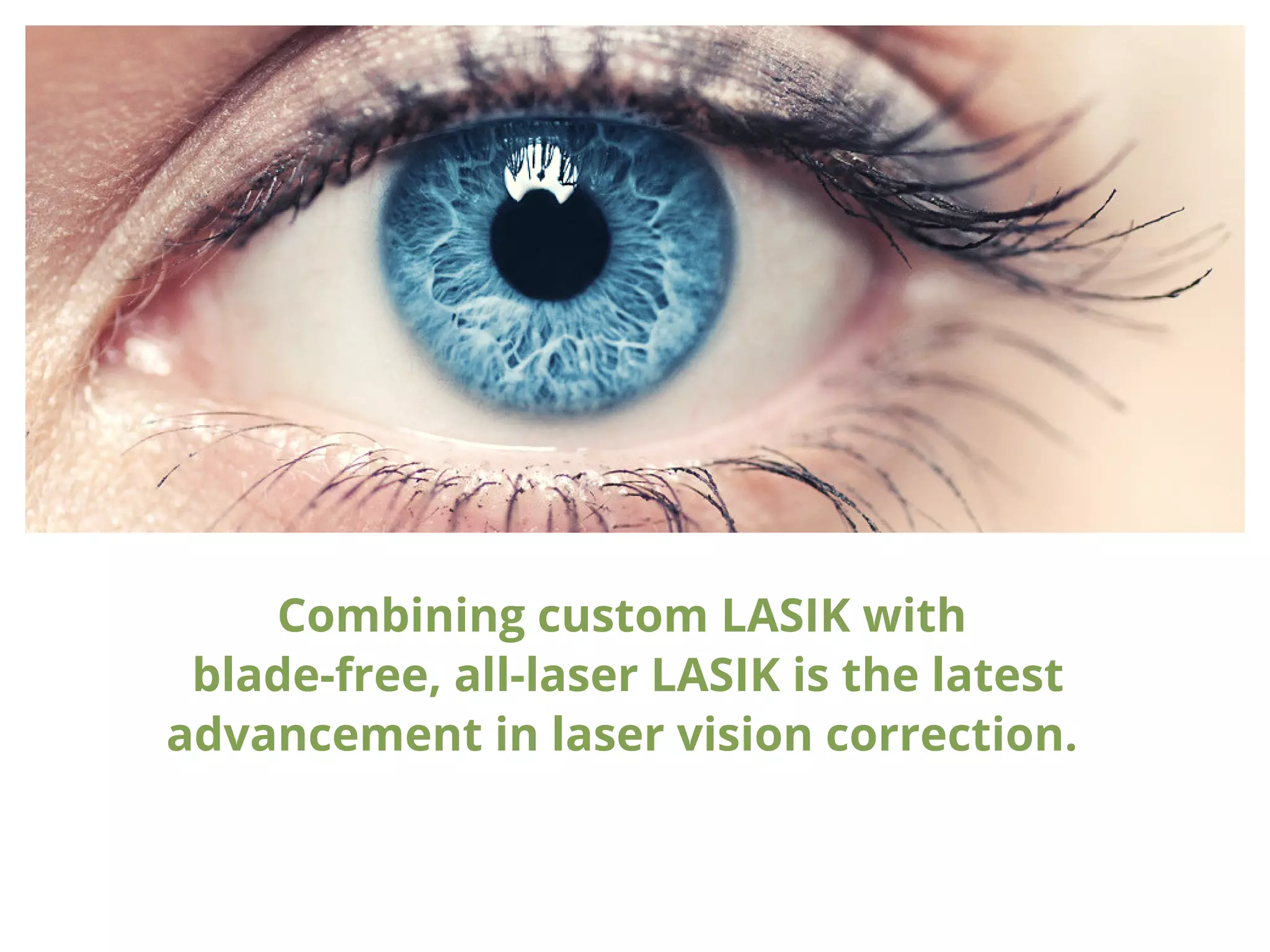 Custom LASIK | PPT