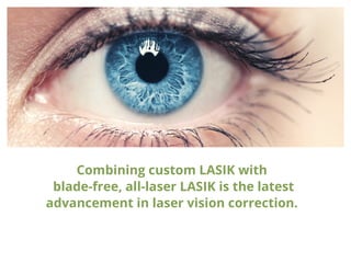Custom LASIK | PPT