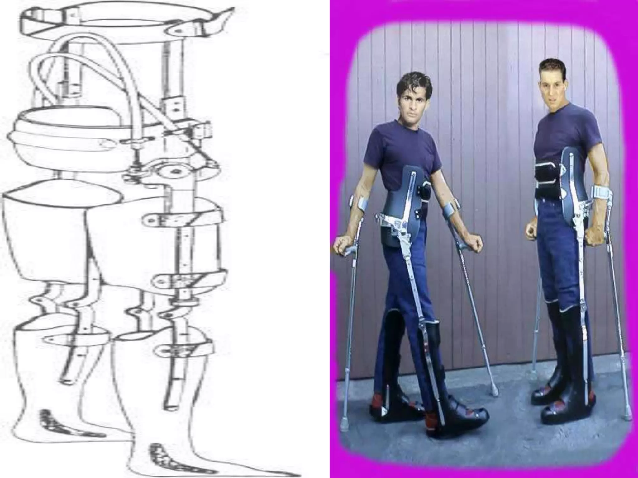 Custom made Orthoses | PPT