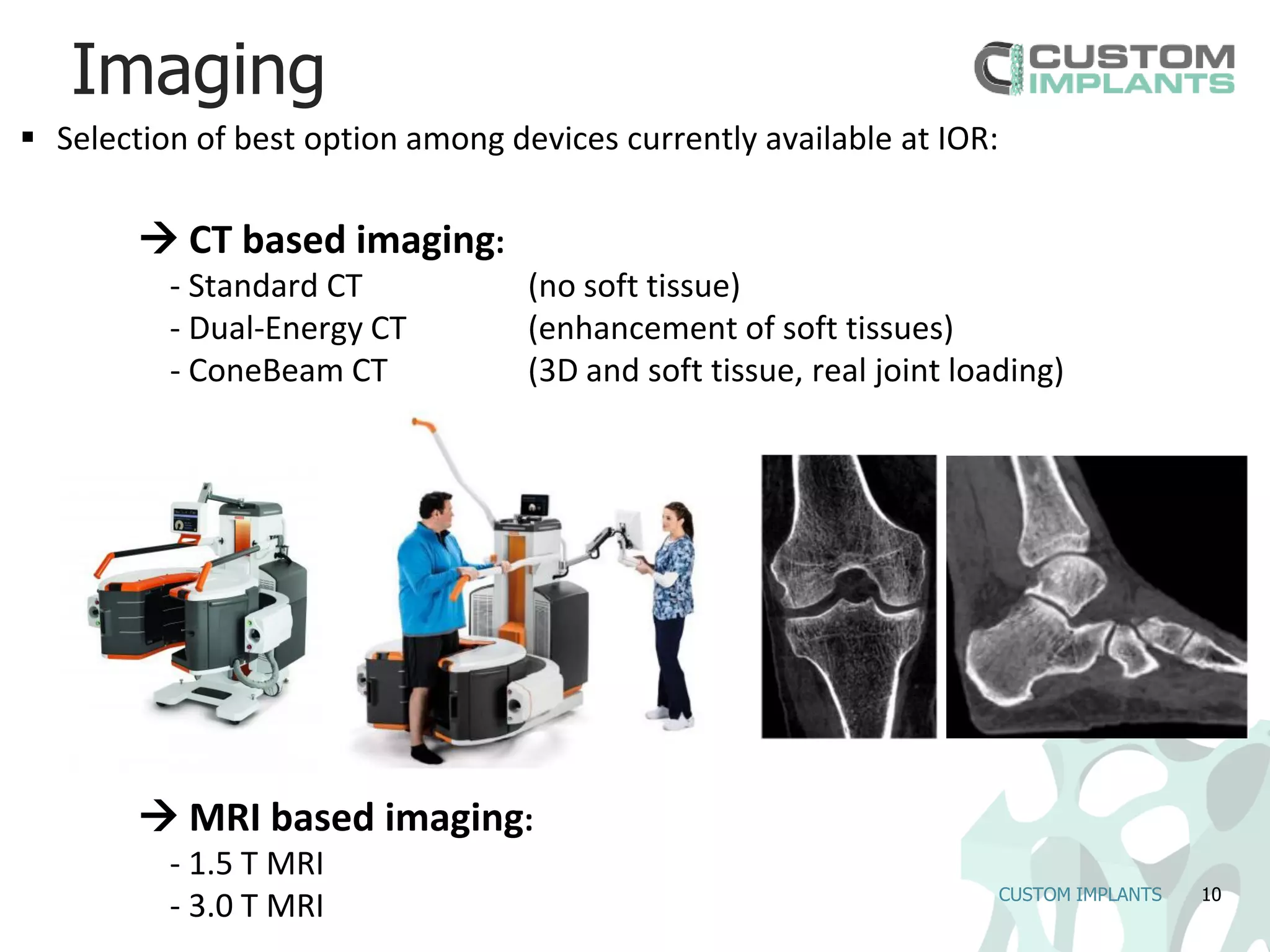 Custom endoprotesi - Design of patient specific ankle prosthesis for ...