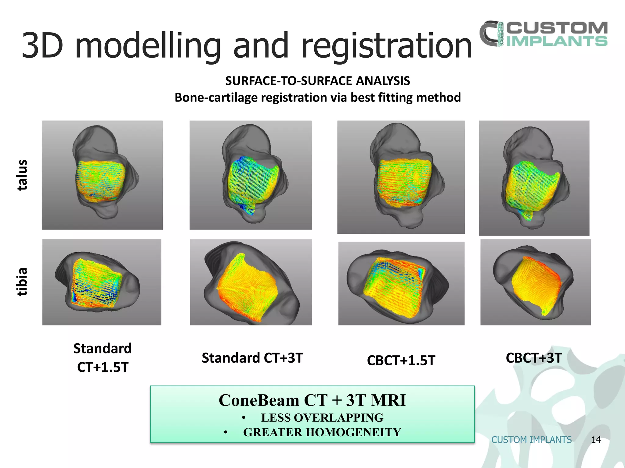 Custom endoprotesi - Design of patient specific ankle prosthesis for ...
