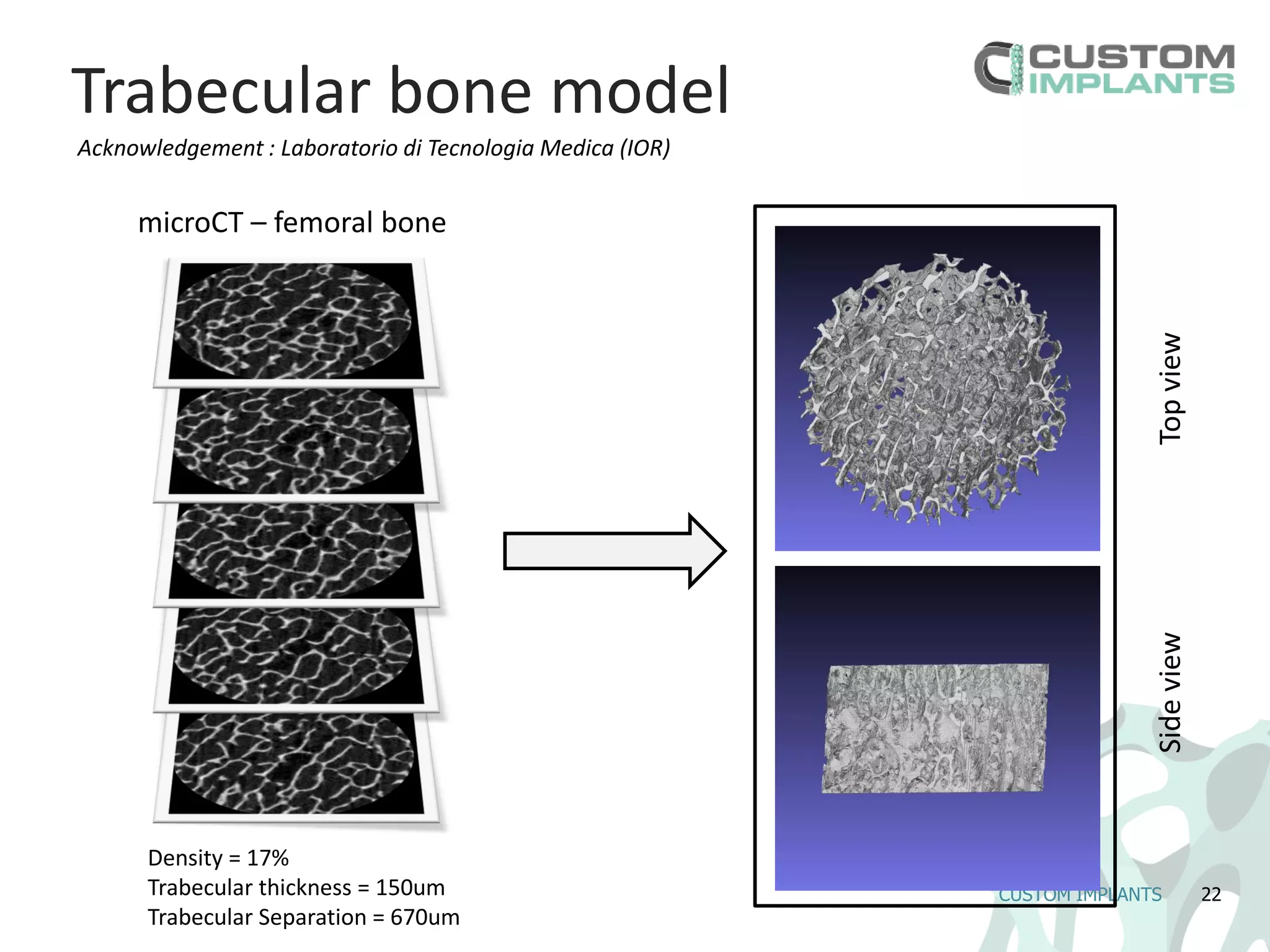 Custom endoprotesi - Design of patient specific ankle prosthesis for ...