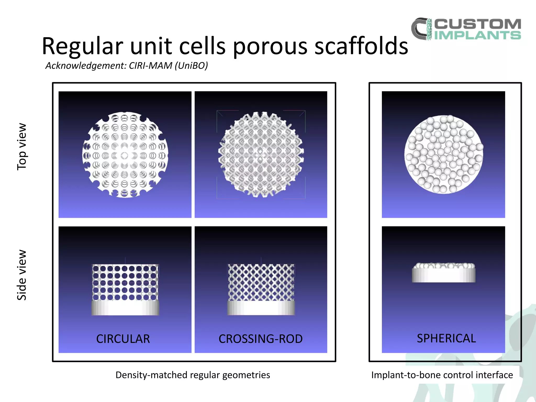Custom endoprotesi - Design of patient specific ankle prosthesis for ...