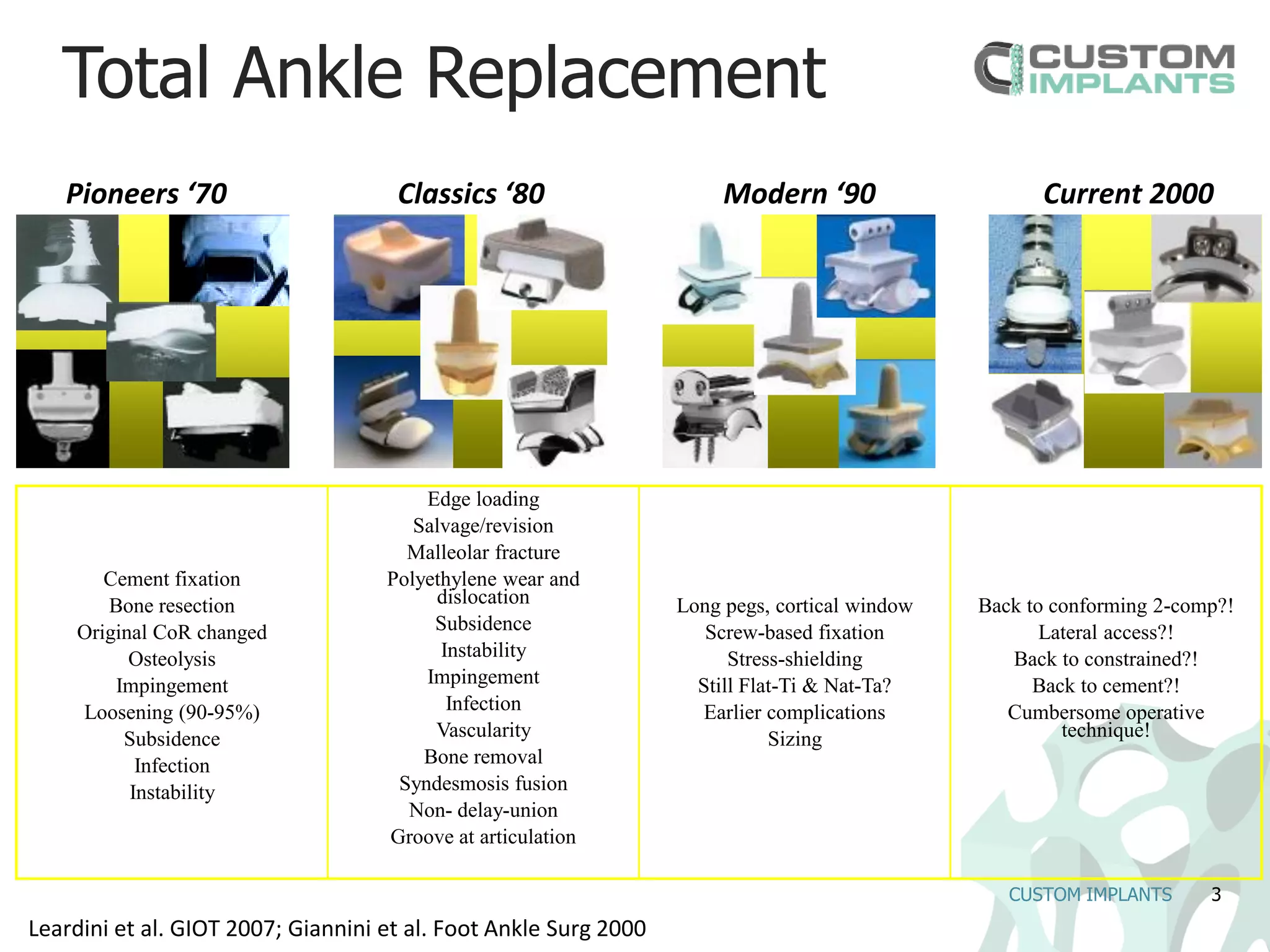 Custom endoprotesi - Design of patient specific ankle prosthesis for ...