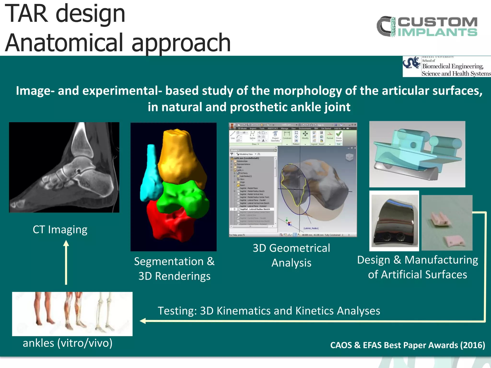 Custom endoprotesi - Design of patient specific ankle prosthesis for ...