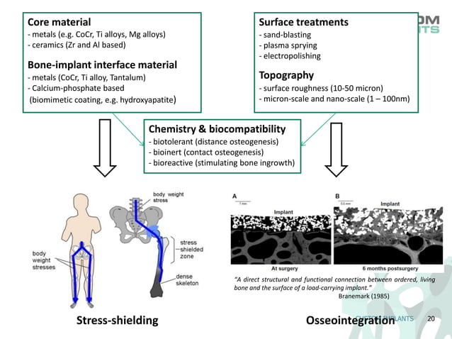 Custom endoprotesi - Design of patient specific ankle prosthesis for ...