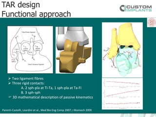 Custom endoprotesi - Design of patient specific ankle prosthesis for ...