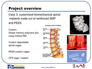 Custom Imd Project Customized Implants | PPT