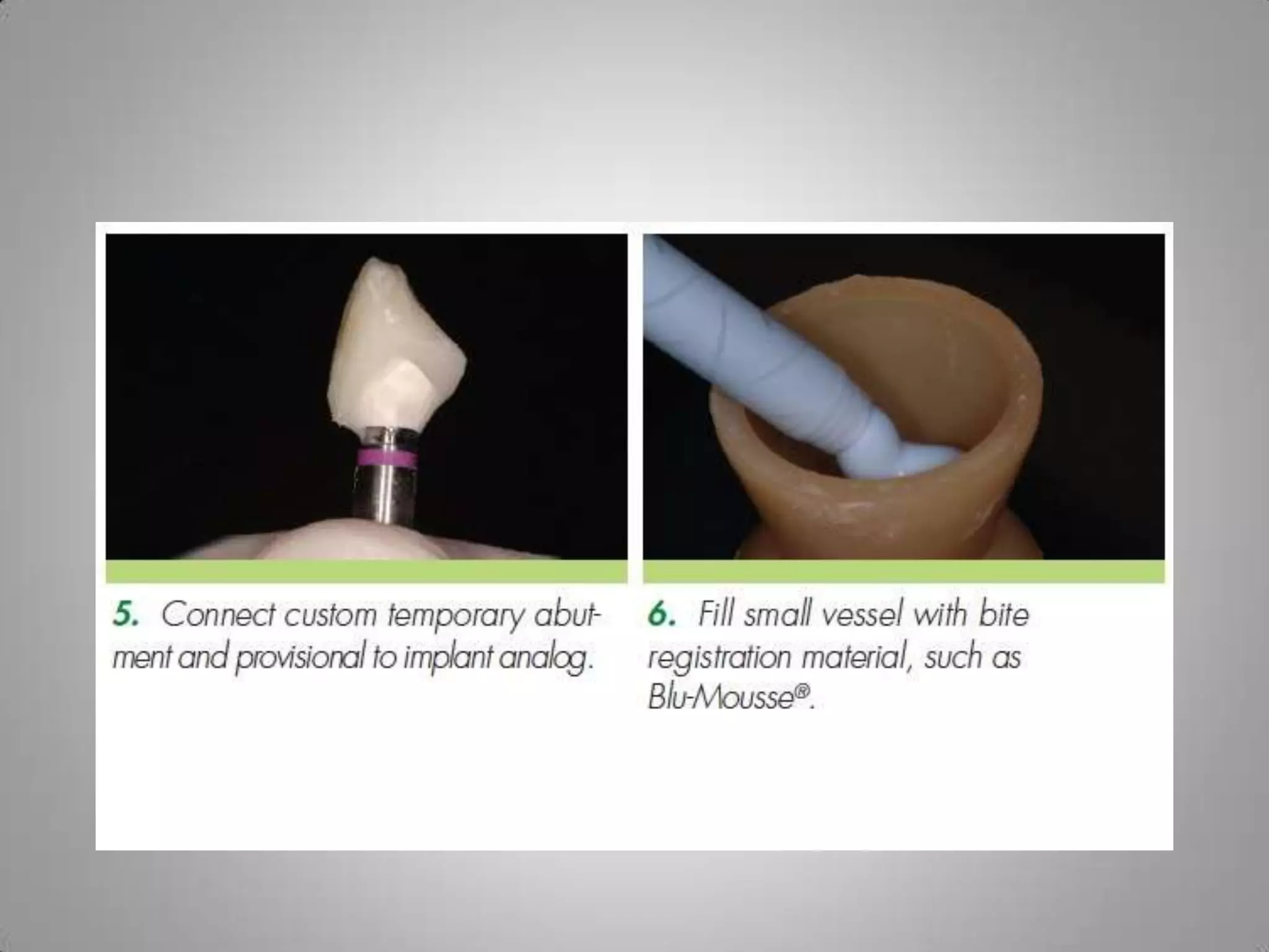 Customized Dental Implant Impression Post Technique | PPTX