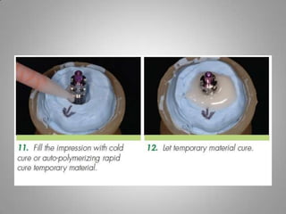 Customized Dental Implant Impression Post Technique | PPTX