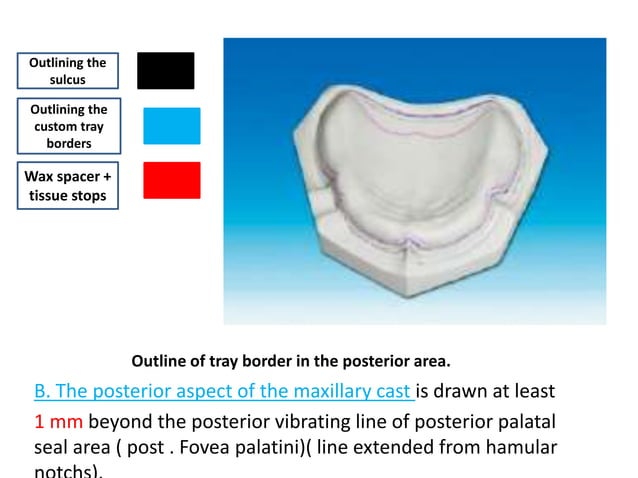 custom tray.pptx | Oral care | Personal Care