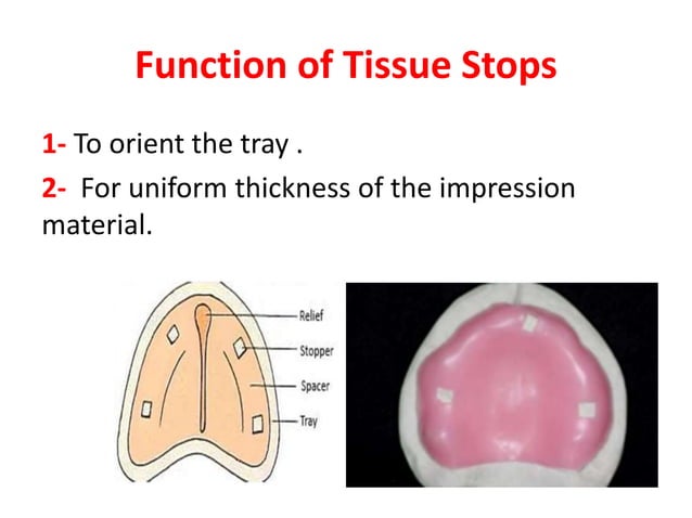 custom tray.pptx | Oral care | Personal Care