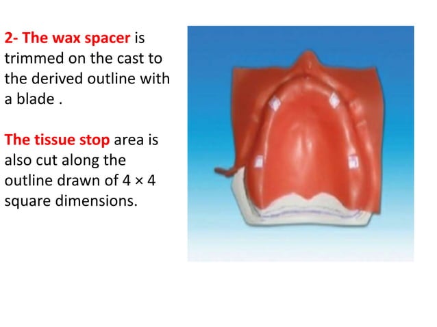 custom tray.pptx | Oral care | Personal Care