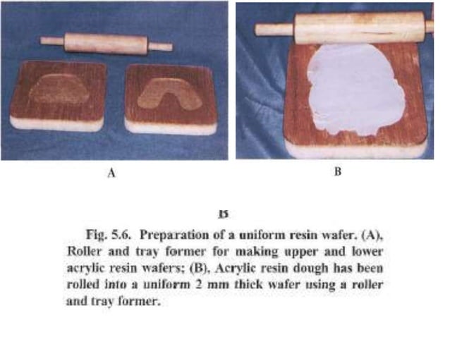 custom tray.pptx | Oral care | Personal Care