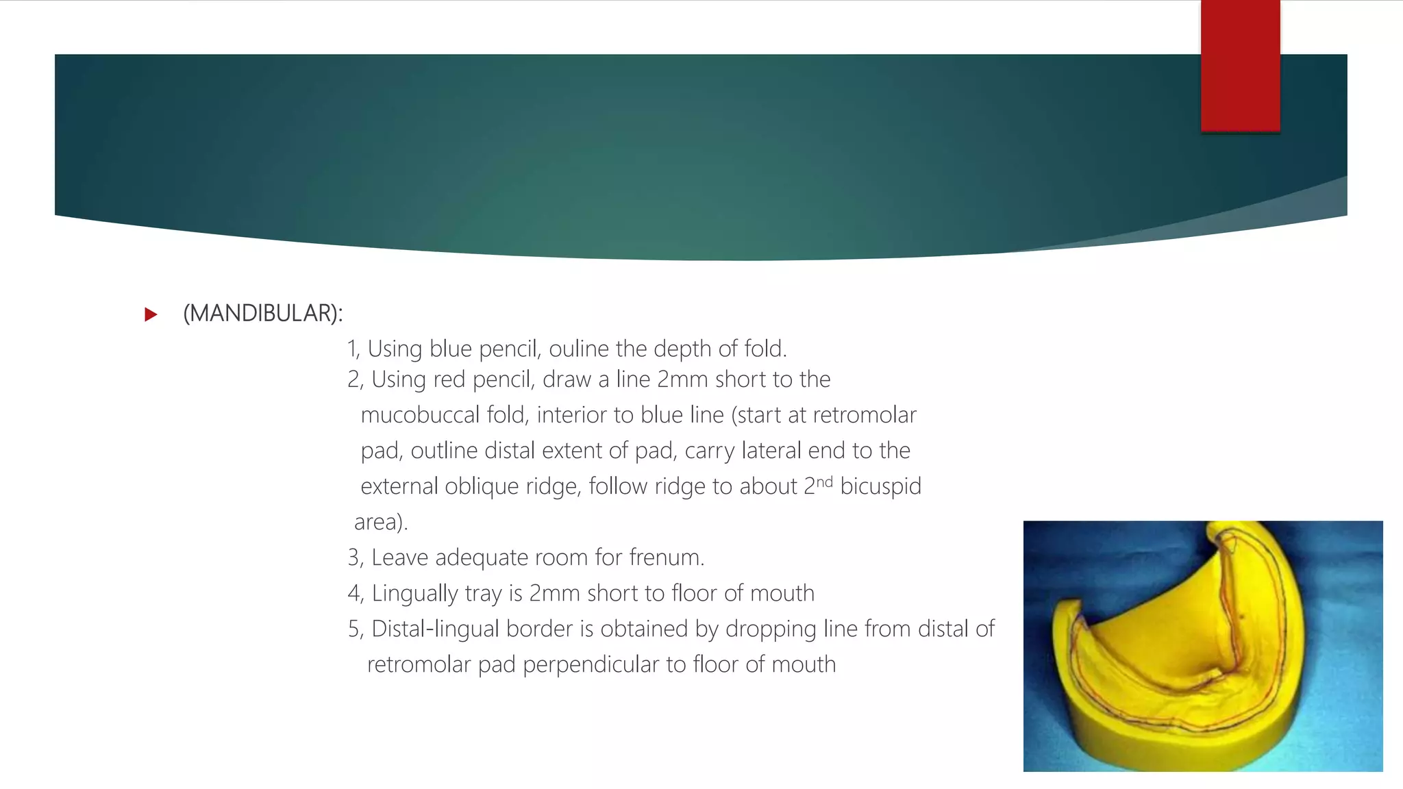 Custom tray fabrication and materials in complete denture | PPTX