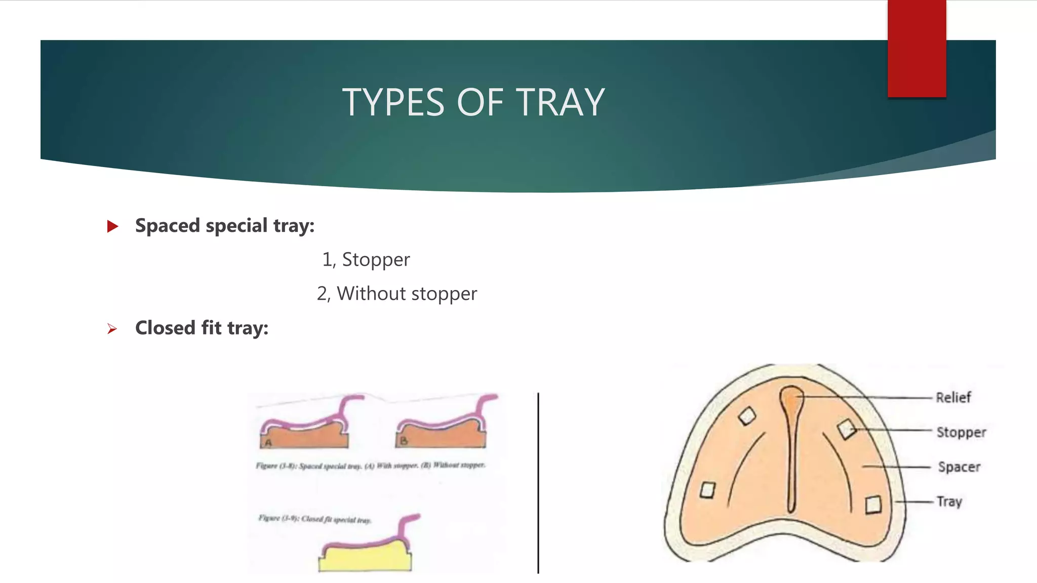 Custom tray fabrication and materials in complete denture | PPTX