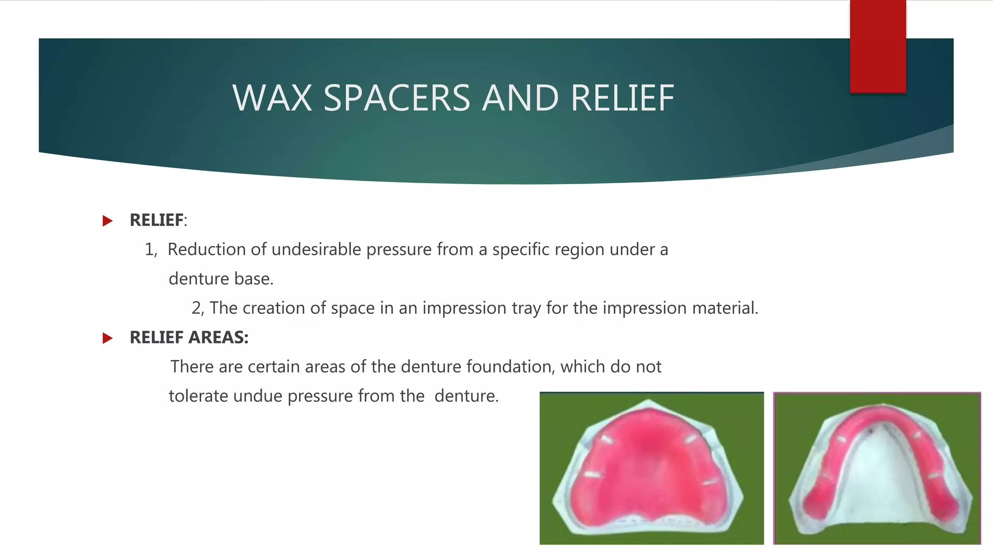 Custom tray fabrication and materials in complete denture | PPTX