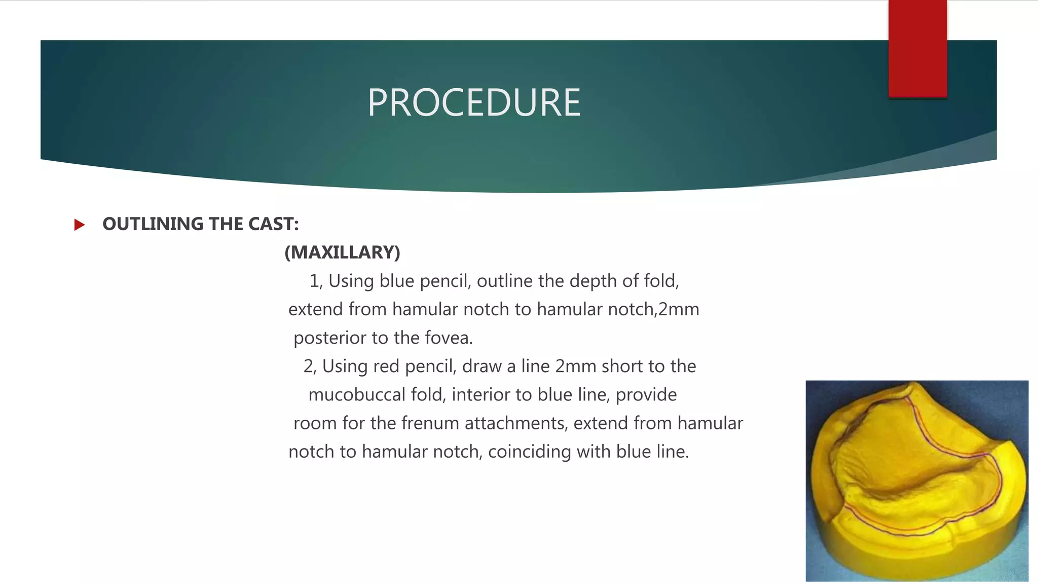 Custom tray fabrication and materials in complete denture | PPTX