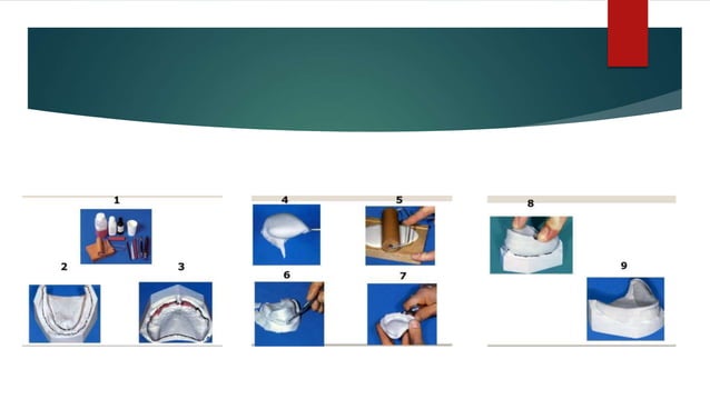 Custom tray fabrication and materials in complete denture | PPTX