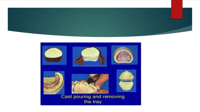 Custom tray fabrication and materials in complete denture | PPTX