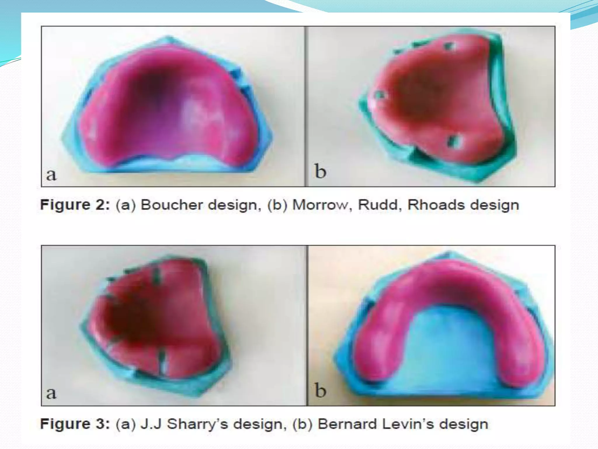 CUSTOM TRAYS AND SPACER DESIGNS.pptx