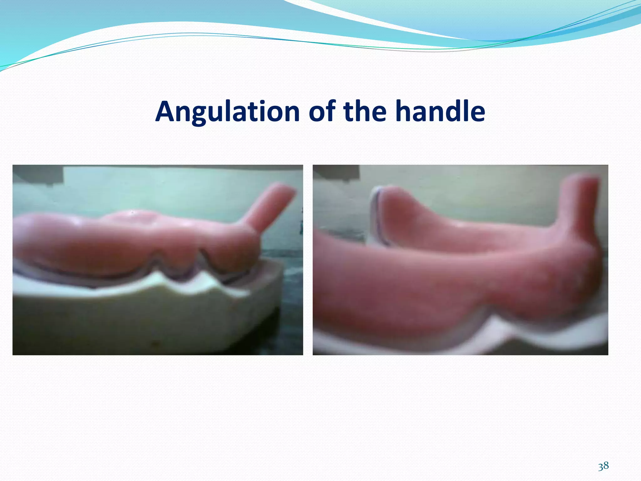 CUSTOM TRAYS AND SPACER DESIGNS.pptx