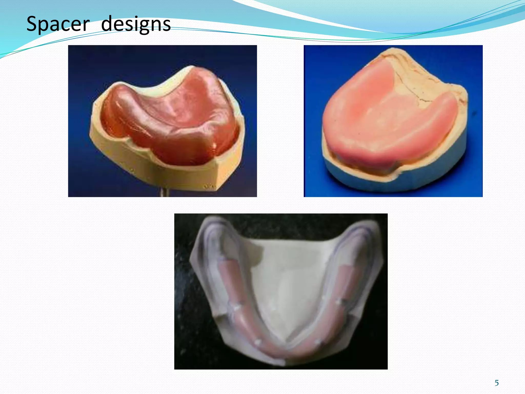 CUSTOM TRAYS AND SPACER DESIGNS.pptx