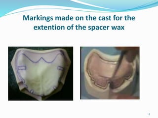 CUSTOM TRAYS AND SPACER DESIGNS.pptx