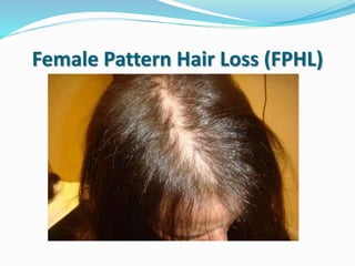 Cutaneous Signs of Androgenization | PPT