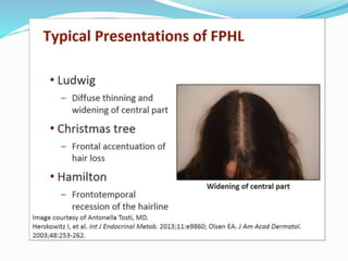 Cutaneous Signs of Androgenization | PPT