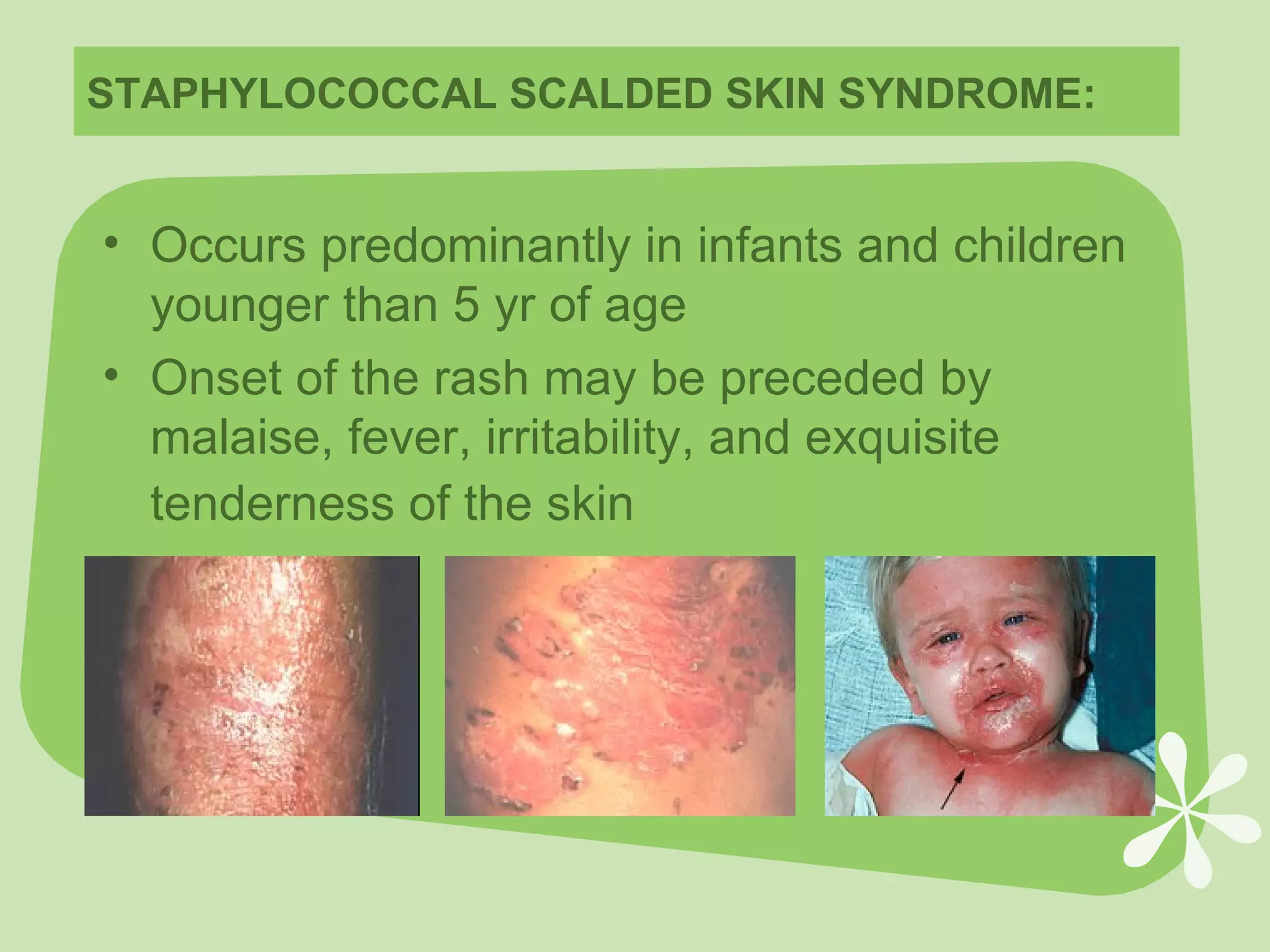 Cutaneous Bacterial Infections | PPT