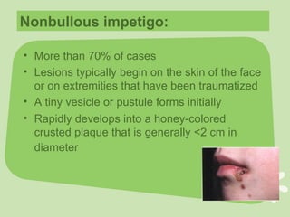 Cutaneous Bacterial Infections | PPT
