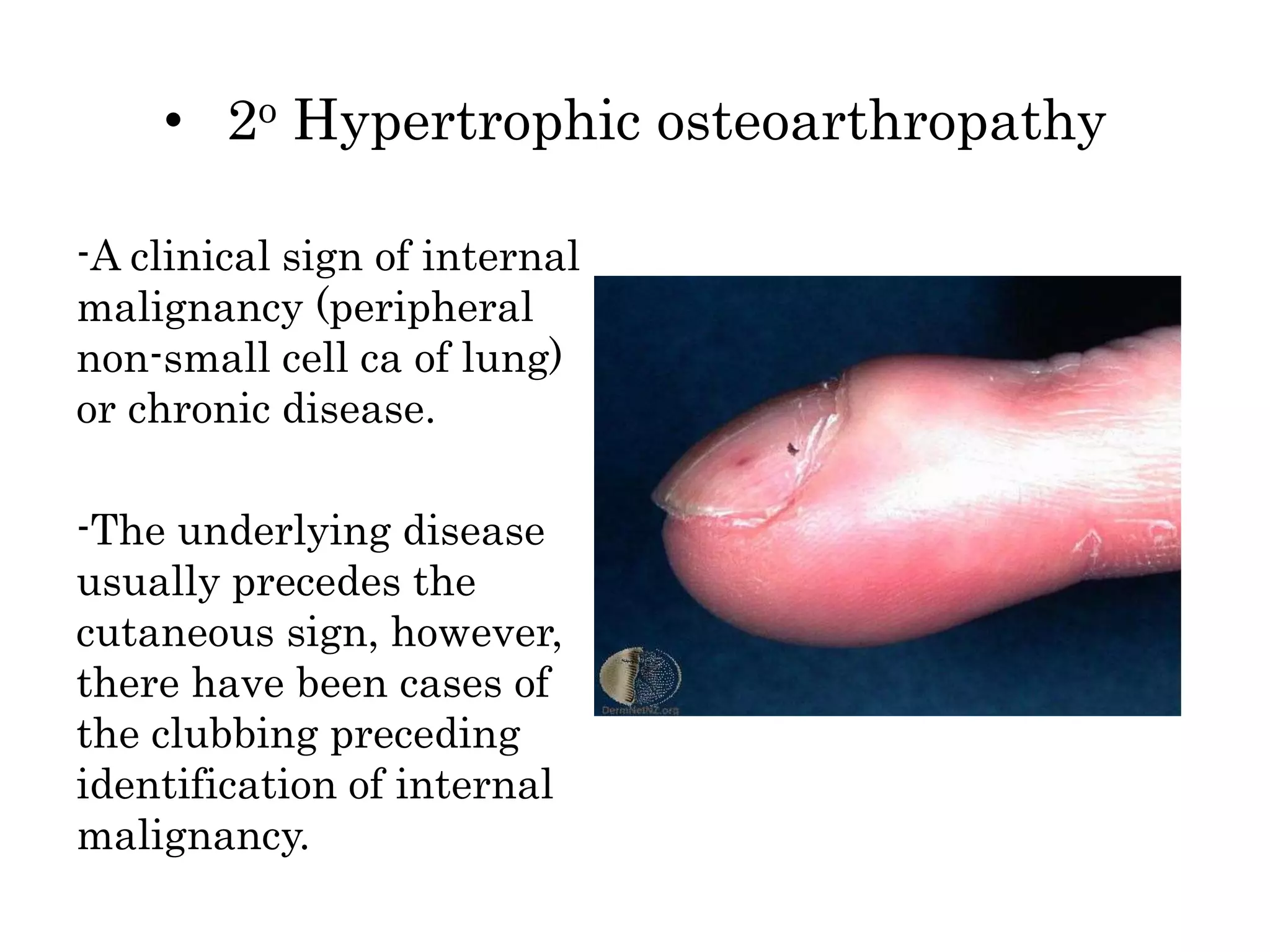 Cutaneous presentation of tumours | PPTX