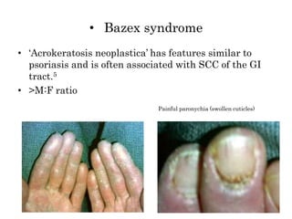 Cutaneous presentation of tumours | PPTX