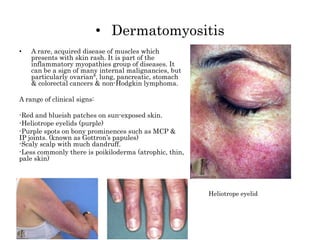 Cutaneous presentation of tumours | PPTX
