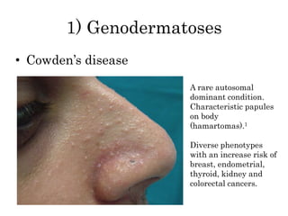 Cutaneous presentation of tumours | PPTX