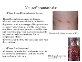 Cutaneous presentation of tumours | PPTX